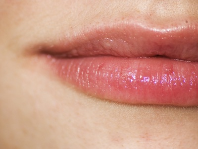 Eos Lip Balm Allergic Reaction