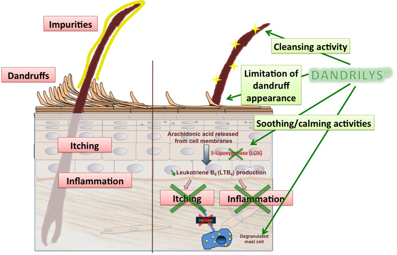 Dandruff Diagram
